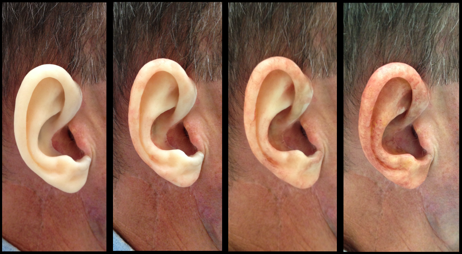 Prosthodontists & Maxillofacial Prosthetics - Reno, NV | Andresen DDS ...