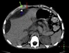 Diagnostics: The Shunt Series — Taming the SRU