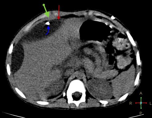 Diagnostics: The Shunt Series — Taming the SRU