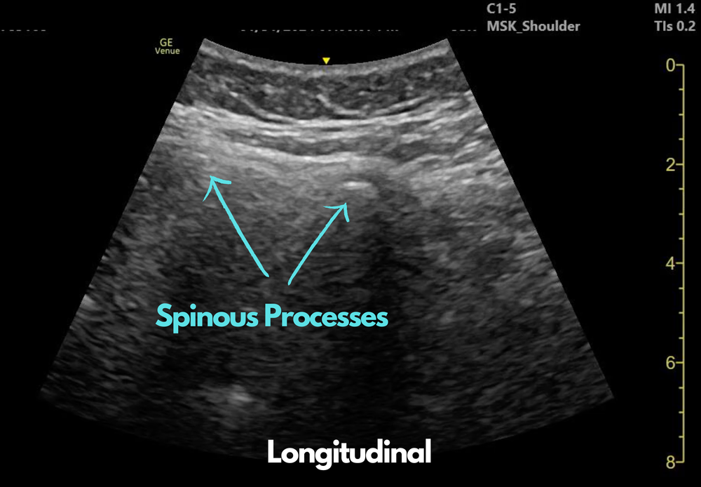 Diagnostics and Therapeutics: The Who, What, Where, When and Why of ...