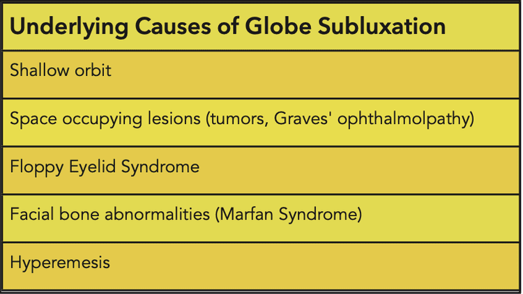 Annals of B Pod: Acute Globe Subluxation — Taming the SRU