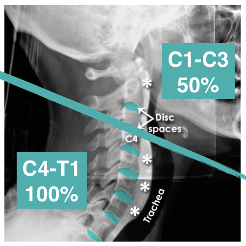Soft Tissue Neck Radiographs — Taming the SRU