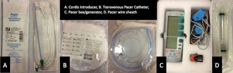 Transvenous Pacemaker — Taming the SRU