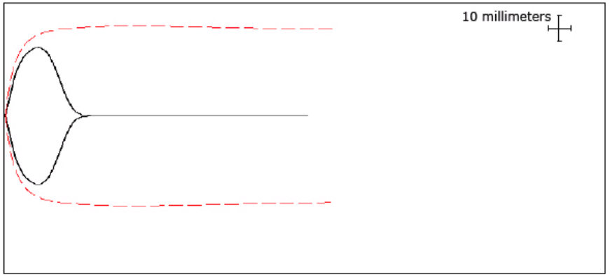 Thromboelastography aka The TEG — Taming the SRU
