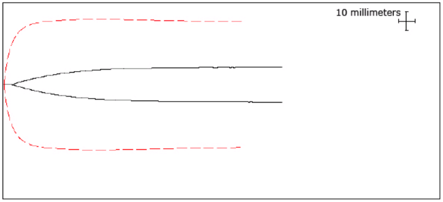 Thromboelastography aka The TEG — Taming the SRU
