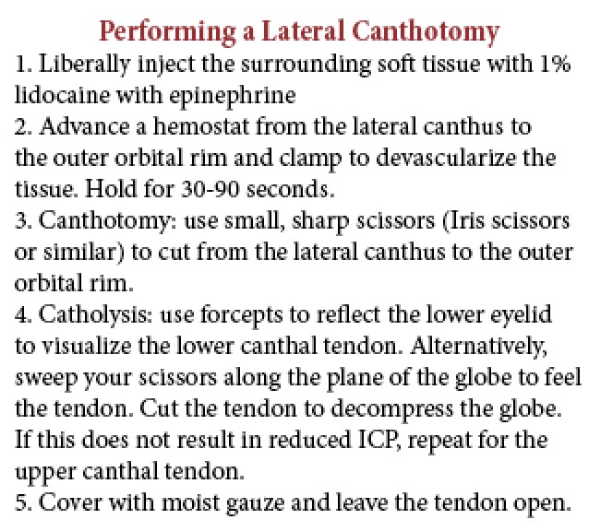 Annals of B-Pod: An Ocular Emergency — Taming the SRU