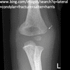 Interpreting Elbow and Forearm Radiographs — Taming the SRU