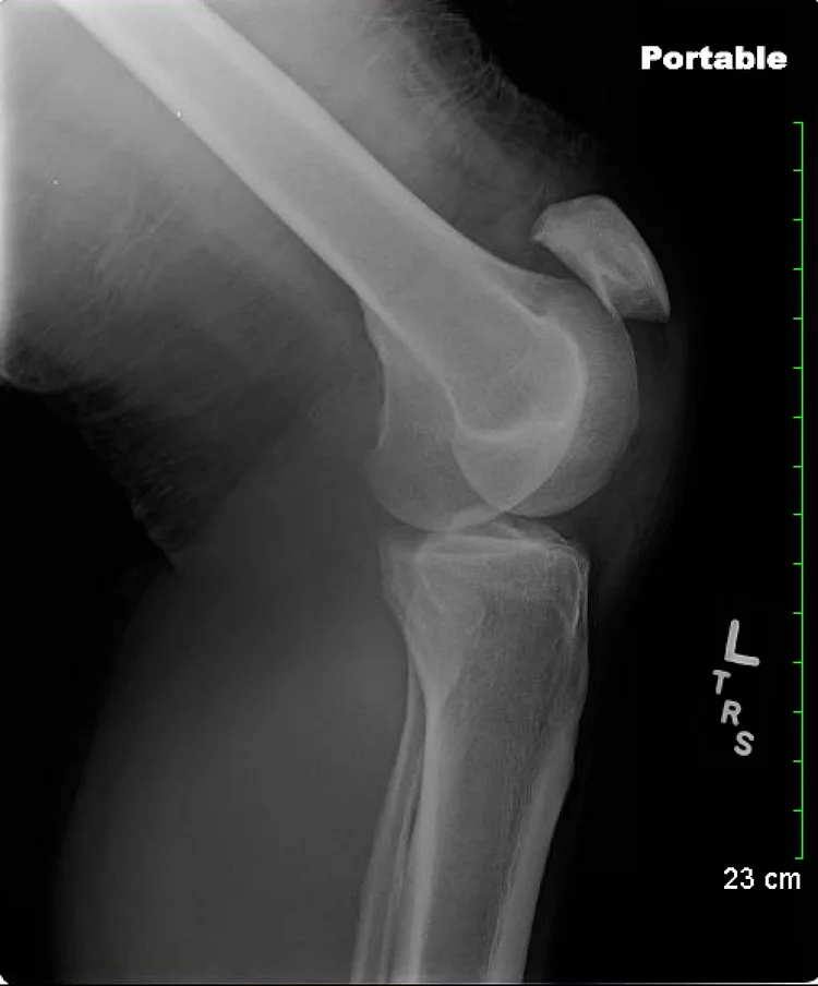 Annals of B-Pod: Quick Hit Case — Taming the SRU