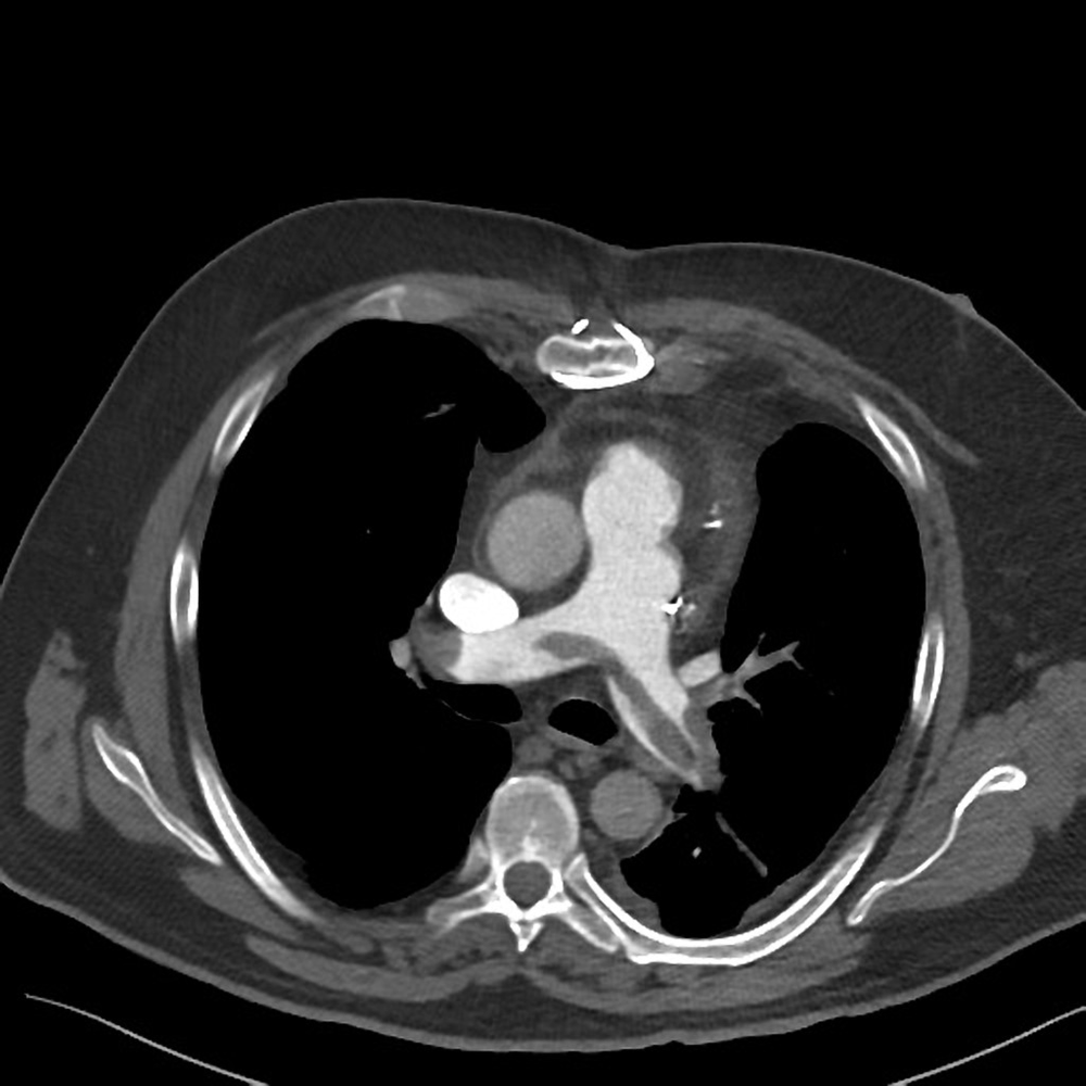 Clinical Concepts in CT Imaging of the Chest — Taming the SRU