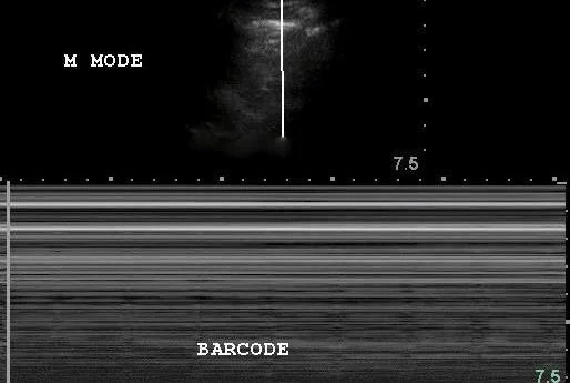 Scanning School - FAST and eFAST — Taming the SRU