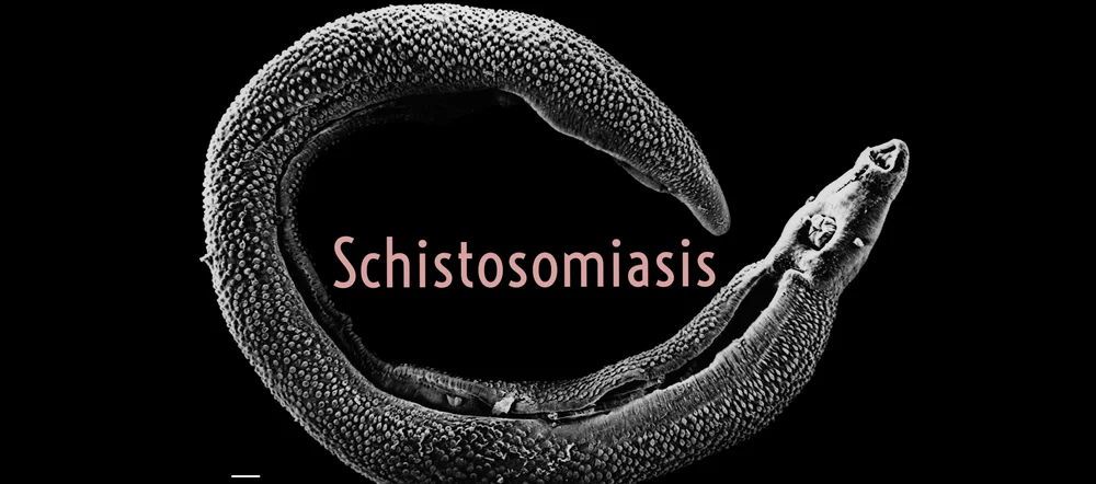 Schistosomiasis — Taming the SRU