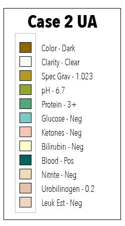 Back to the Basics: Demystifying the UA — Taming the SRU
