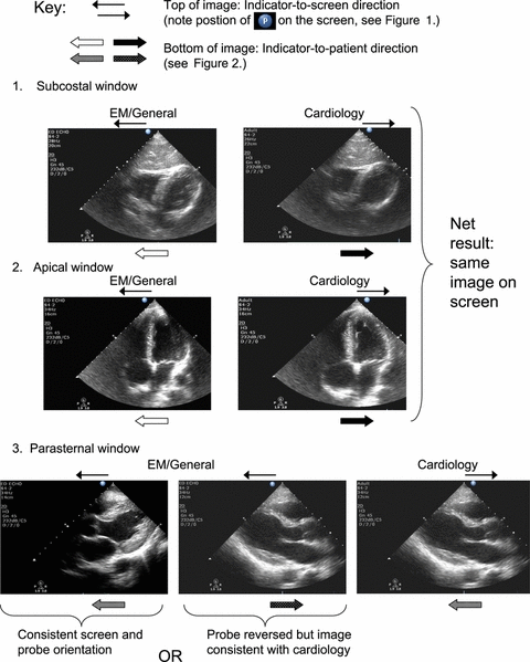 Scanning School - Cardiac — Taming the SRU