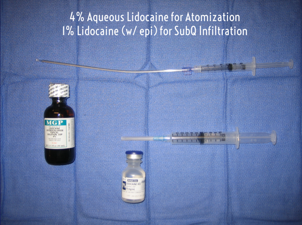 Troublesome Tracheostomies — Taming the SRU