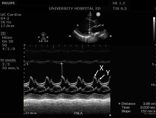 Cardiac Ultrasound Q&A — Taming the SRU