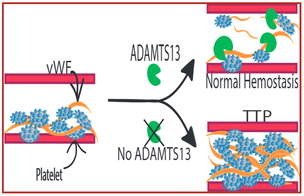 Annals of B-Pod: Thrombotic Thrombocytopenic Purpura — Taming the SRU