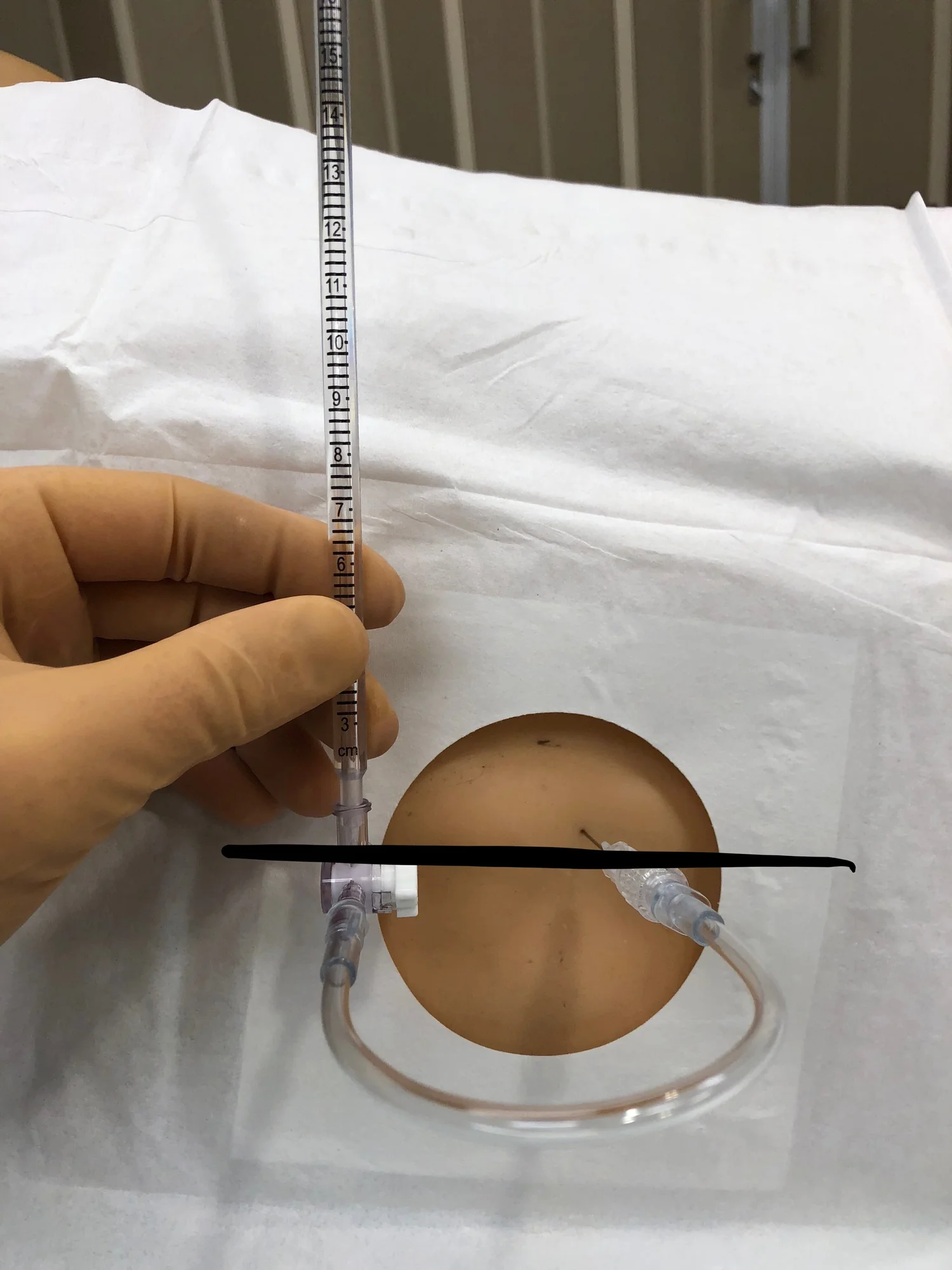 Lumbar Puncture — Taming the SRU