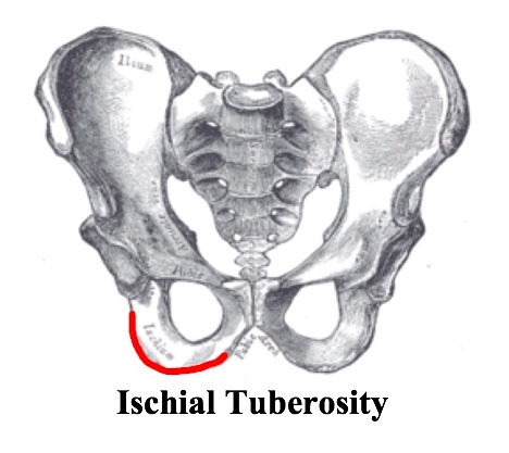 Back to Basics: Pelvic XRays — Taming the SRU