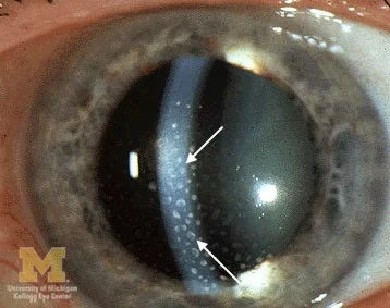 Minor Care Series: Uveitis — Taming the SRU