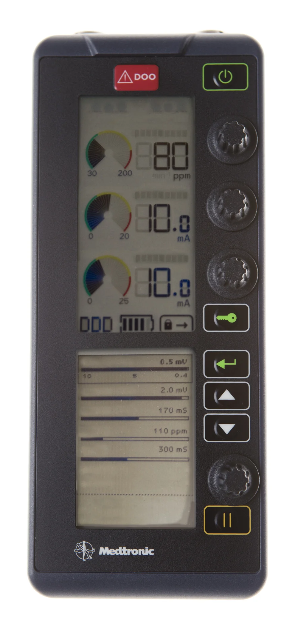 Transvenous Pacemaker — Taming the SRU