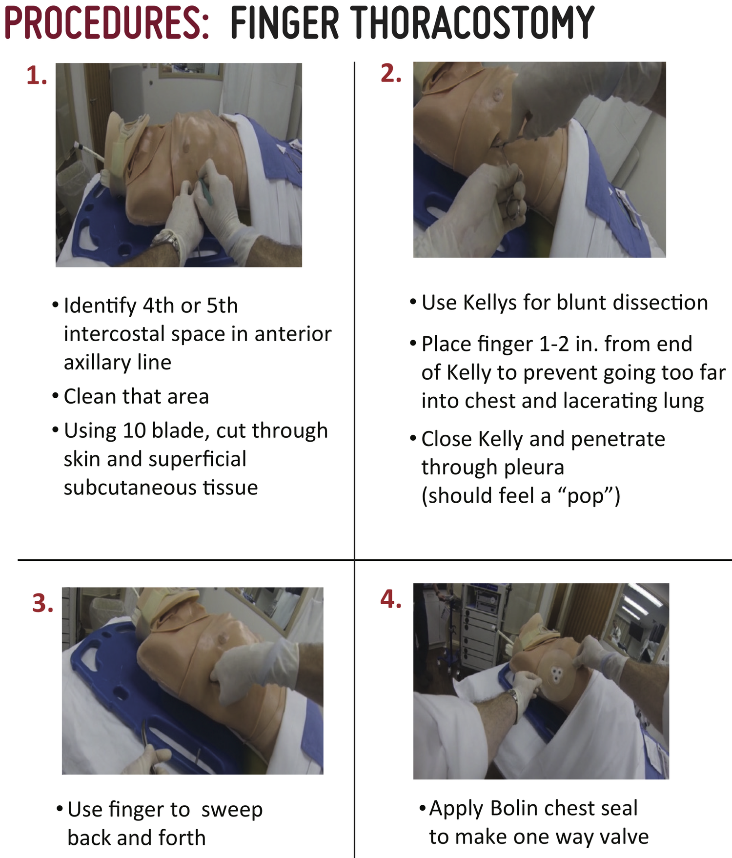 Air Care Procedures Quick Reference — Taming the SRU
