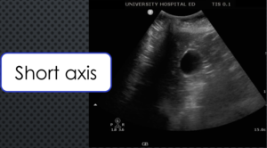 Scanning School - RUQ — Taming the SRU