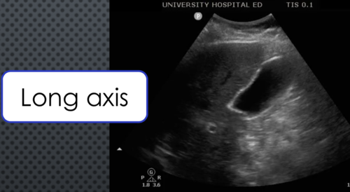 Scanning School - RUQ — Taming the SRU