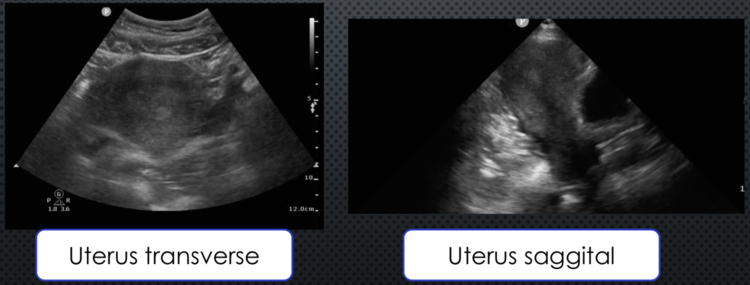 Scanning School - Early Pregnancy — Taming the SRU