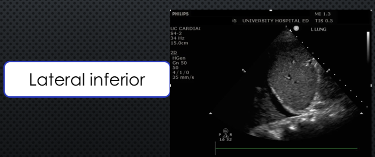 Scanning School - Lung — Taming the SRU