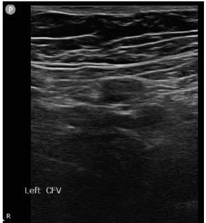 Scanning School - LE Venous — Taming the SRU