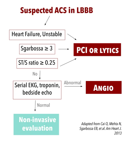 Diagnostics: MI in Left Bundle Branch Block — Taming the SRU