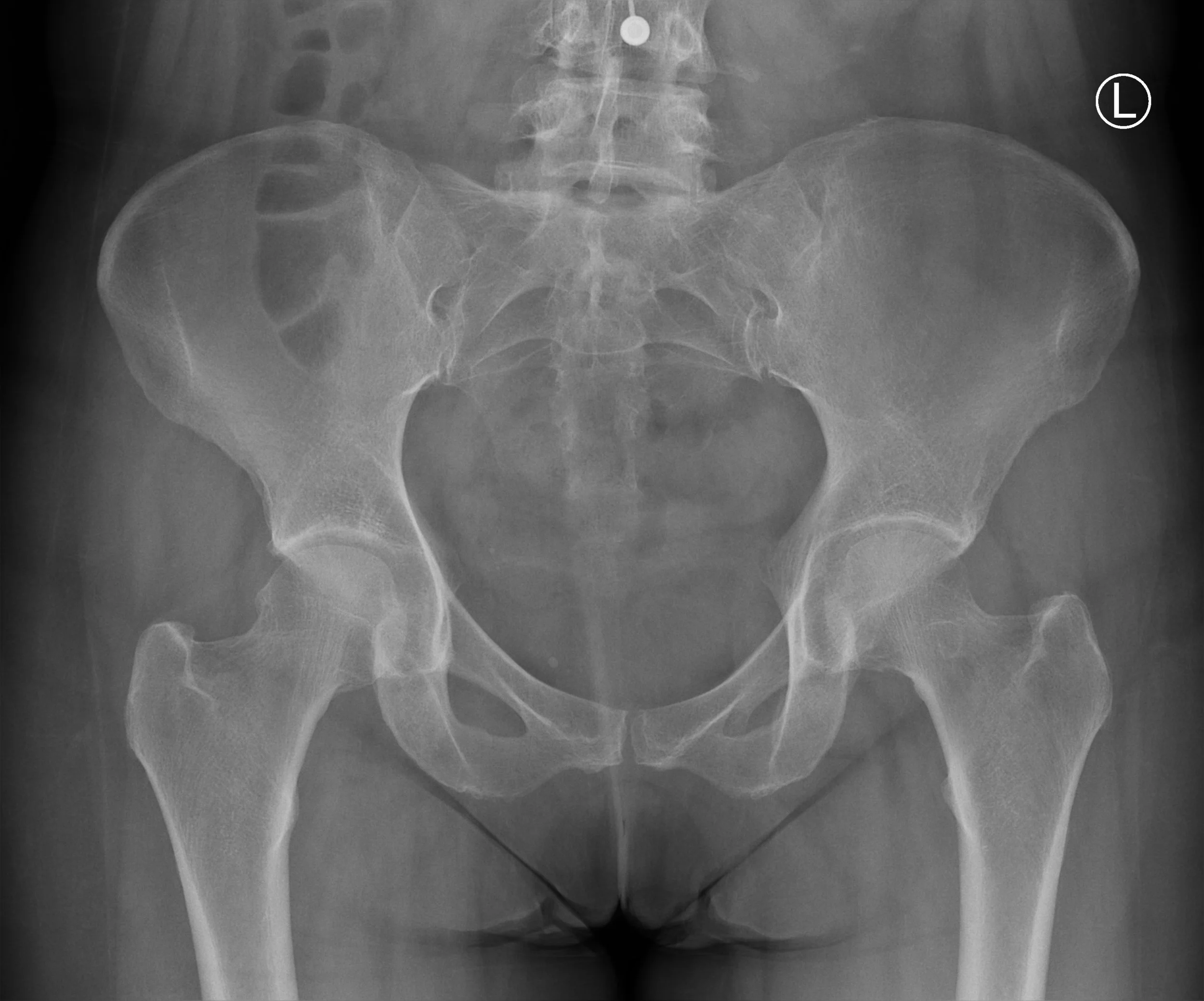 Diagnostics Knee And Ankle X rays Taming The SRU Diagnostics Knee And Ankle X rays Taming The SRU