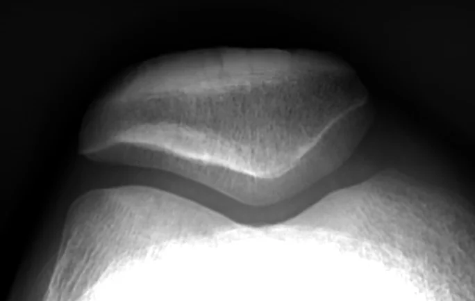 Diagnostics: Knee and Ankle X-rays — Taming the SRU