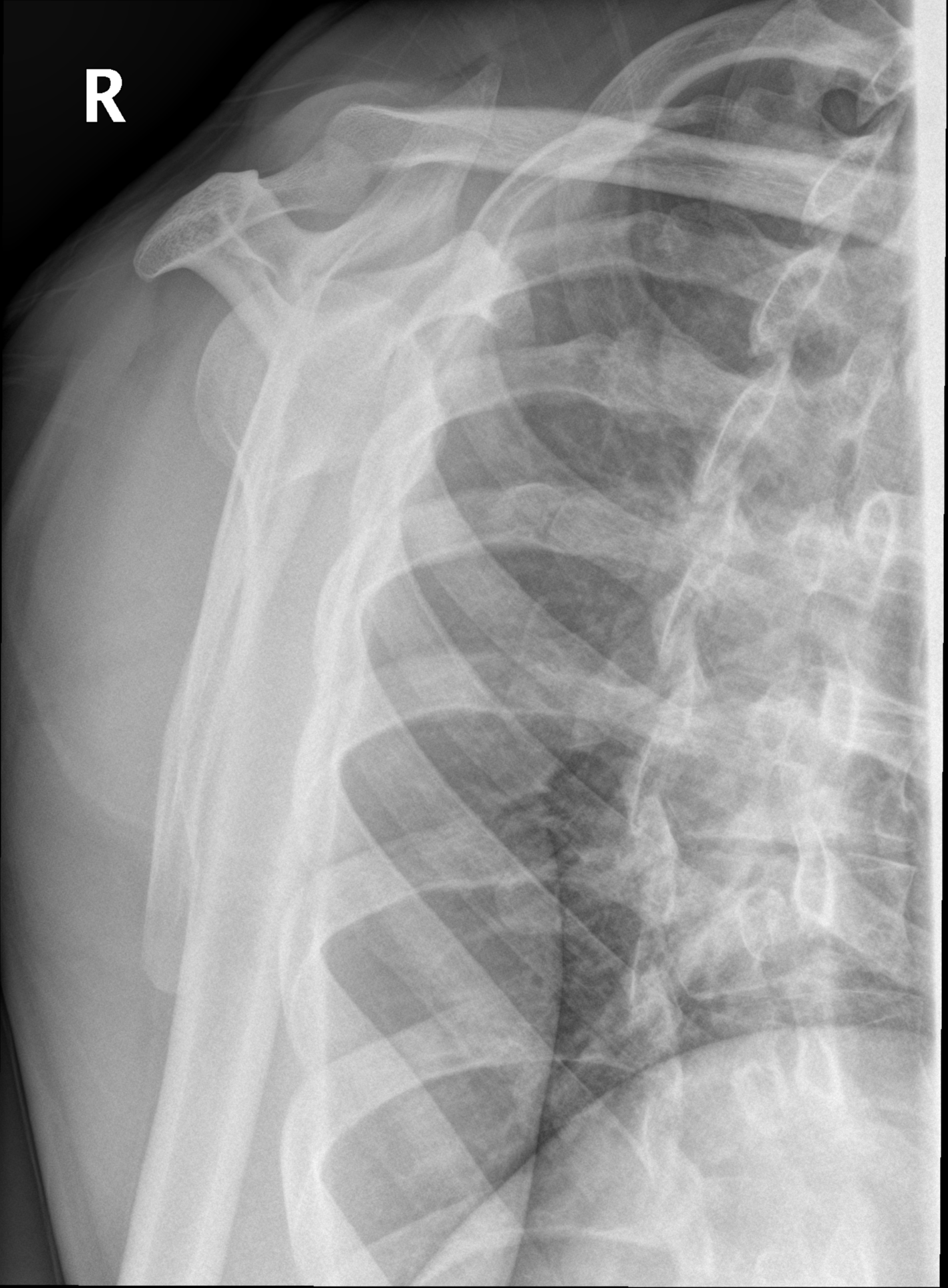 X-ray Vision - Shoulders and Elbows — Taming the SRU