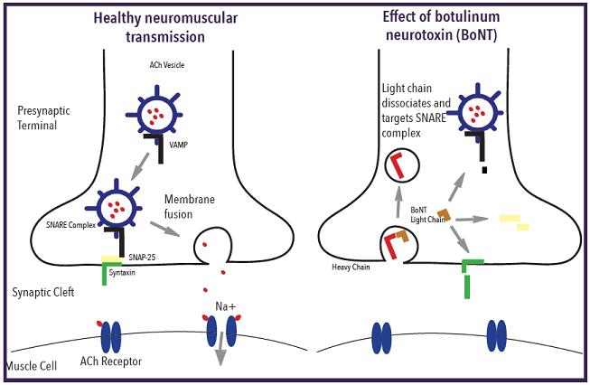 Annals of B Pod - Infantile Botulism — Taming the SRU