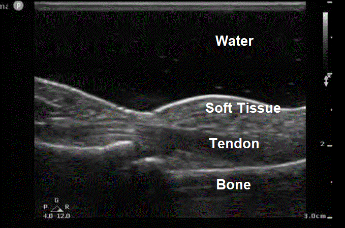 Ultrasound Tips: Always, Always, Always ... — Taming the SRU