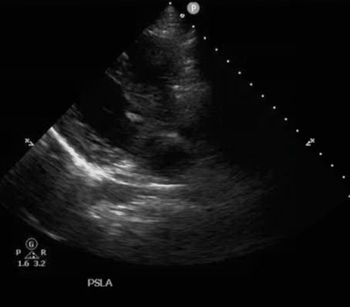 US Case of the Month: October — Taming the SRU