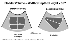 Scanning School - Bladder — Taming the SRU