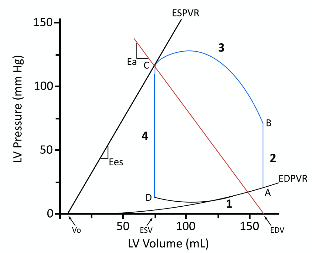 Air Care Series: Pressure-Volume Loop and Impella Support — Taming the SRU