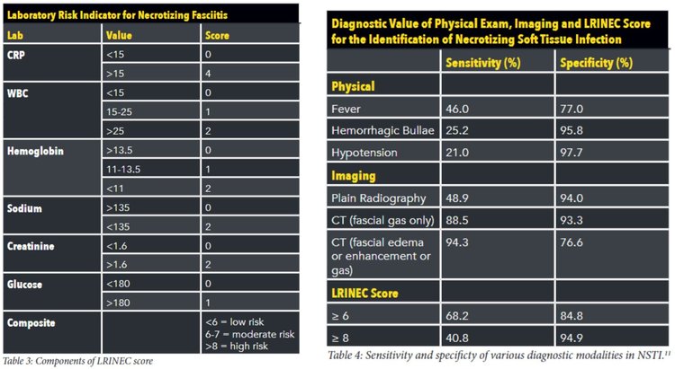 Annals of B Pod - Necrotizing Fasciitis — Taming the SRU