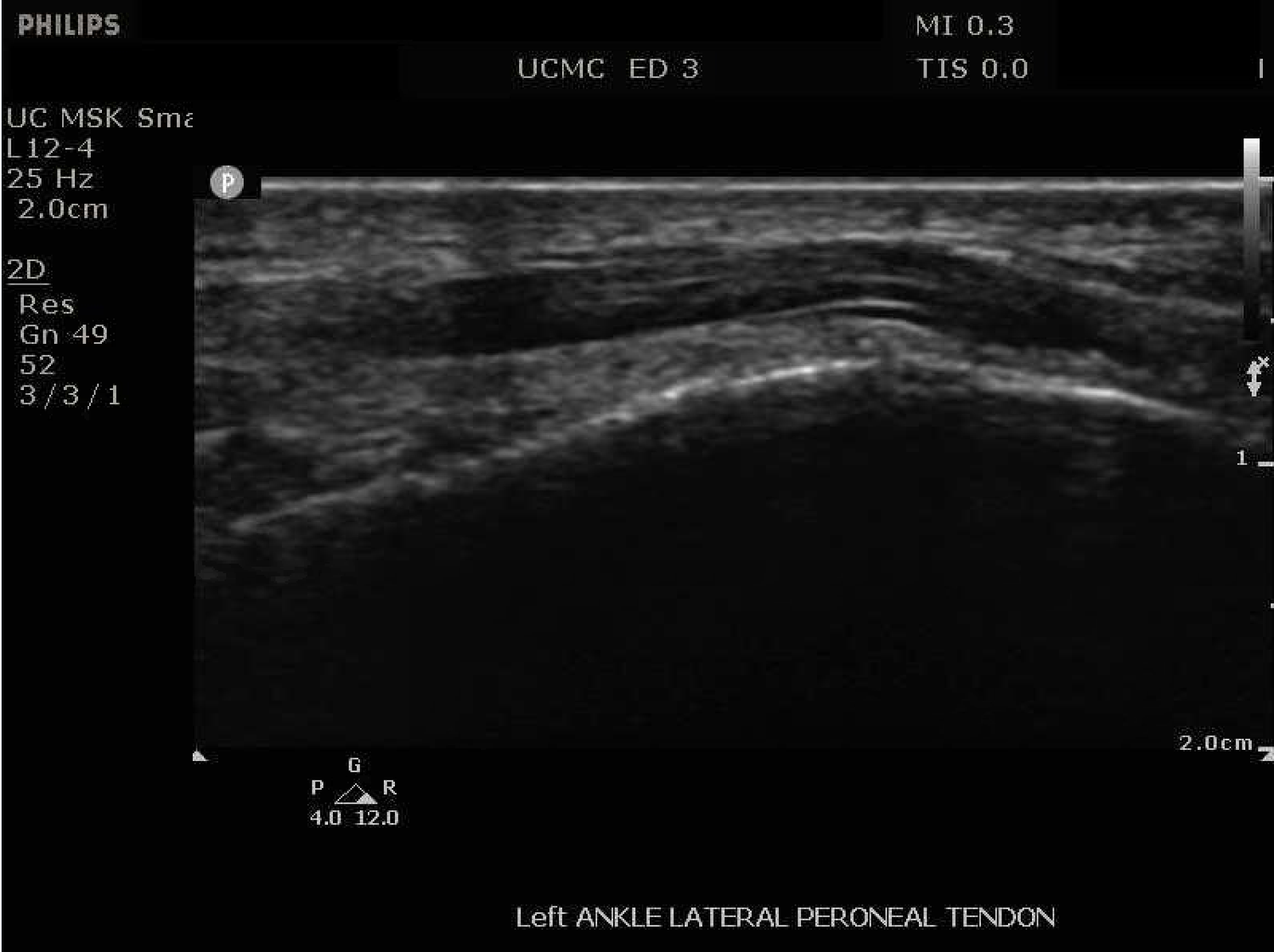 Scanning School - Musculoskeletal — Taming the SRU