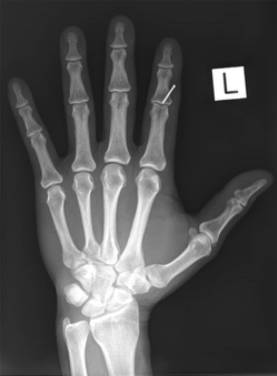 Mastering Minor Care: Hand Lacerations — Taming the SRU