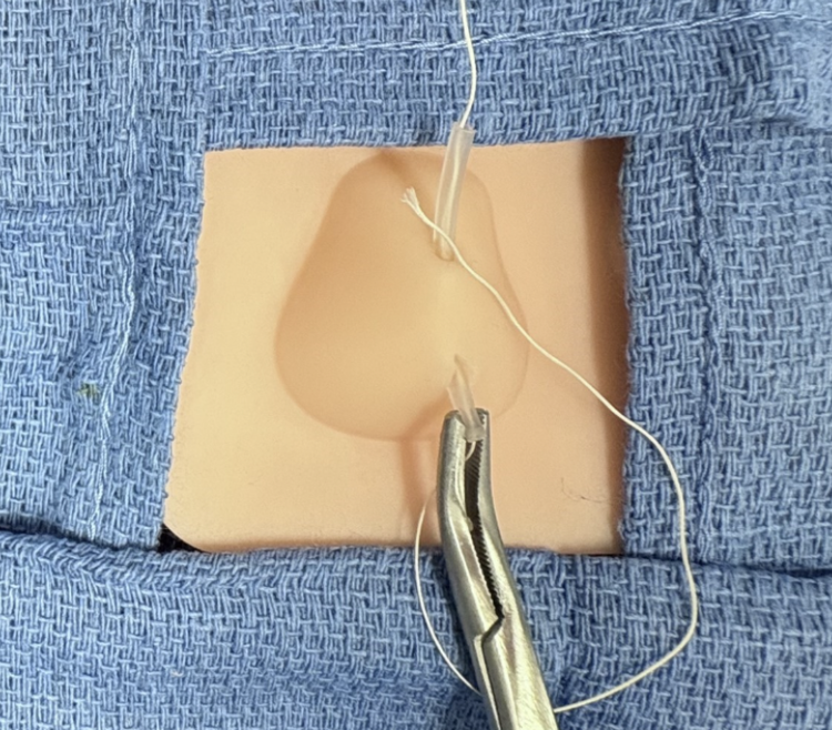 Mastering Minor Care: Bartholin Gland Abscess — Taming the SRU