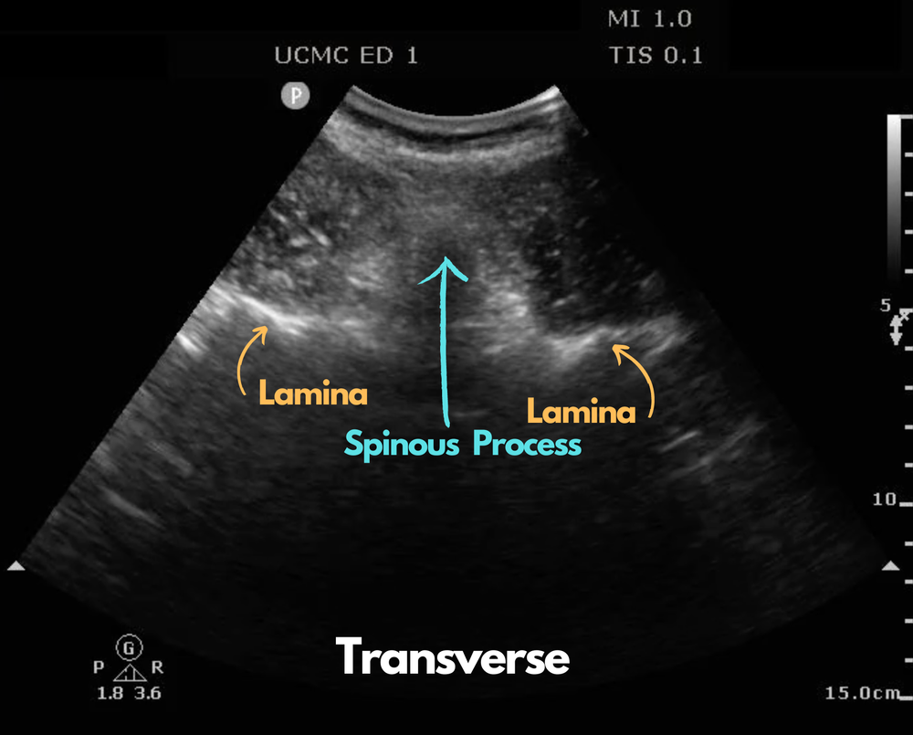 Diagnostics and Therapeutics: The Who, What, Where, When and Why of ...