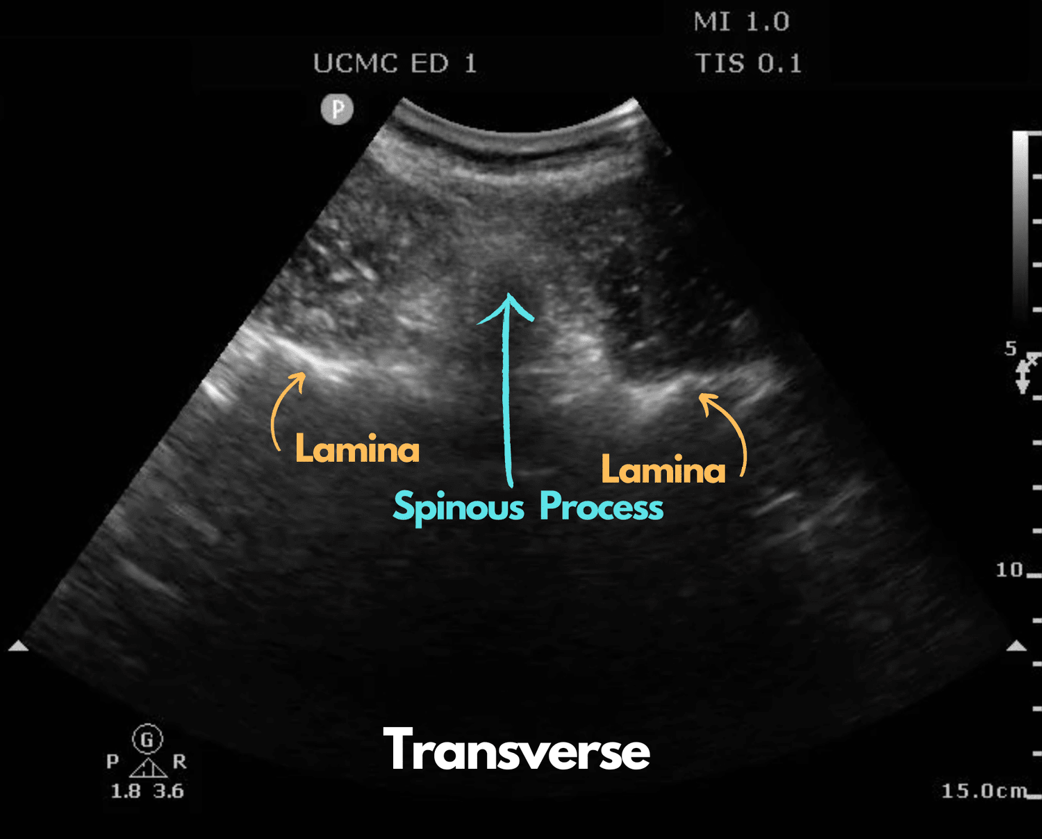 Diagnostics and Therapeutics: The Who, What, Where, When and Why of ...