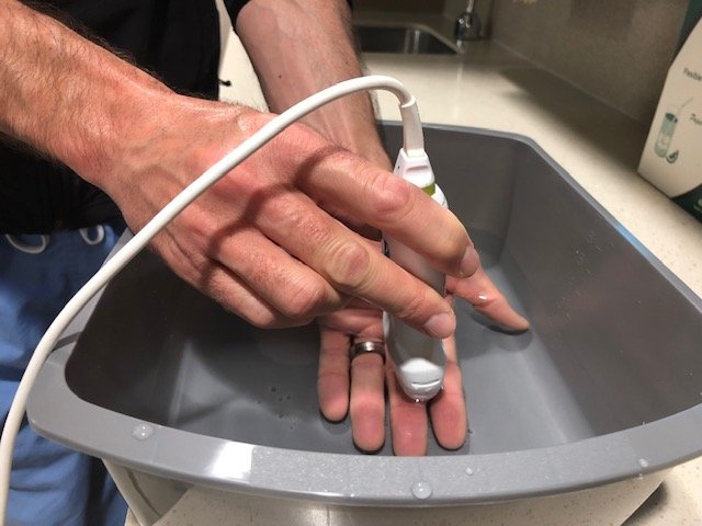 Ultrasound of the Month: Flexor Tenosynovitis — Taming the SRU