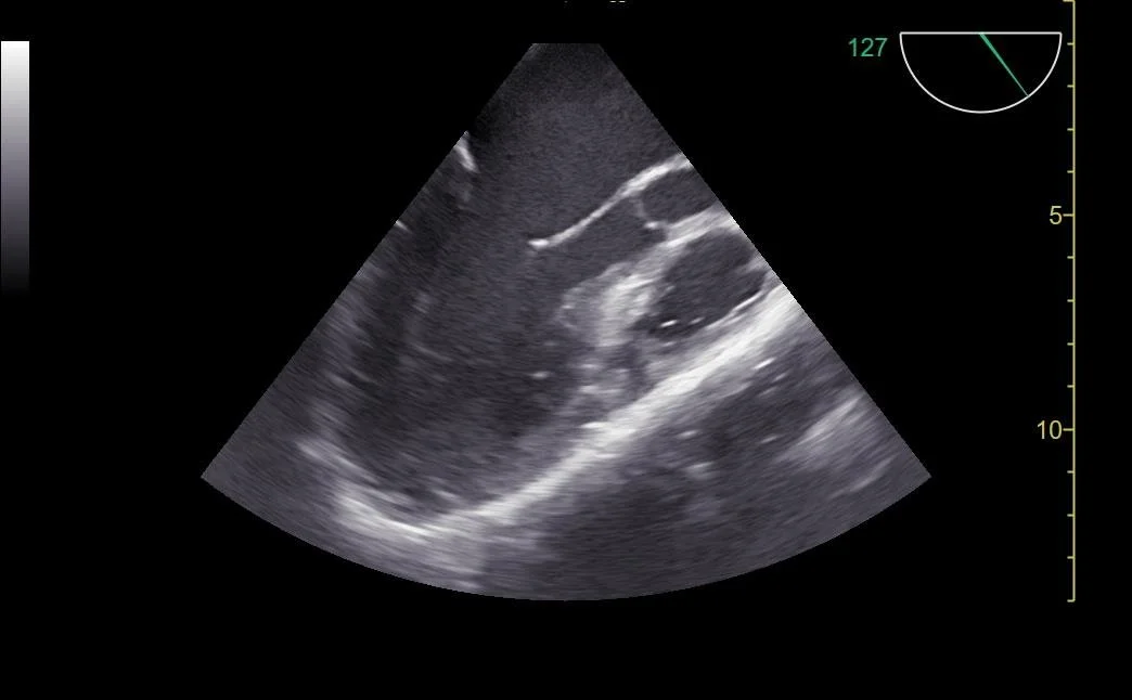 Scanning School - TEE Advanced: Cardiac Arrest Evaluation — Taming the SRU
