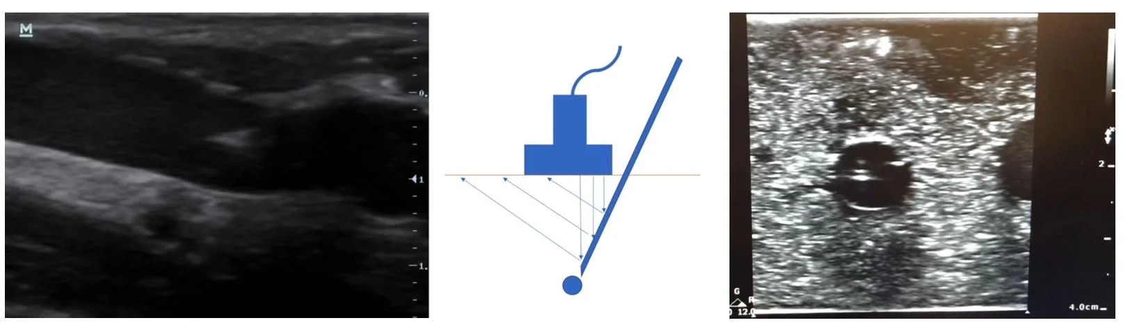 Diagnostics and Therapeutics: Vascular Access in the Emergency Department — Taming the SRU