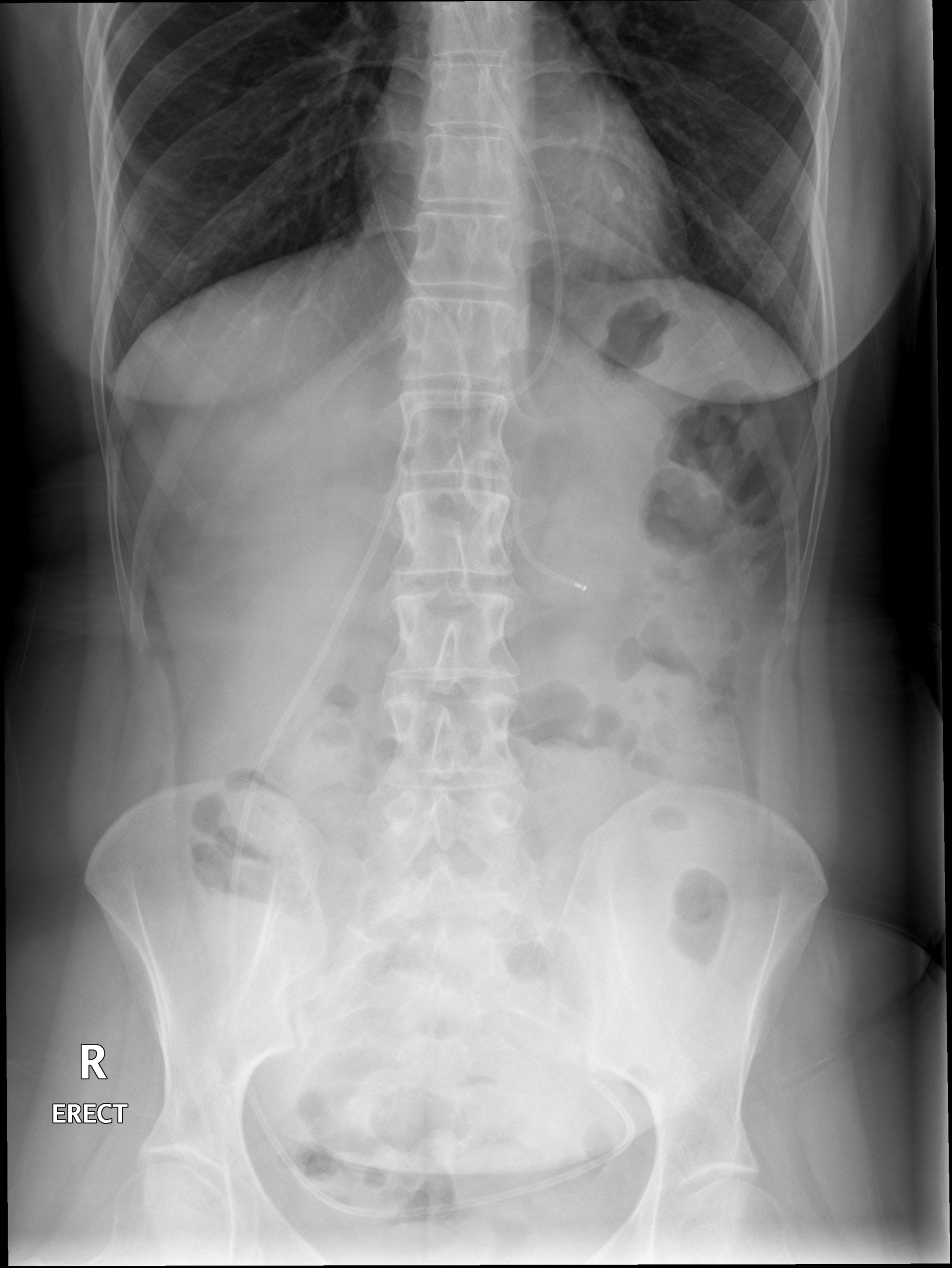 Diagnostics: The Shunt Series — Taming the SRU