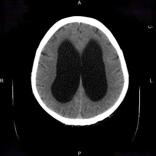 Diagnostics: The Shunt Series — Taming the SRU